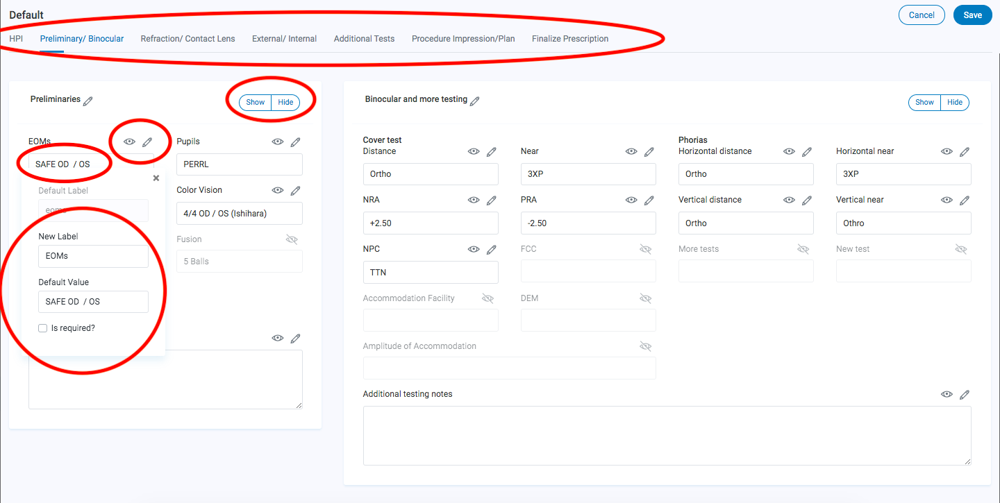 Exam form builder to manage exam default values - iTRUST Optometry Cloud EHR - 2